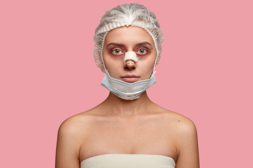 Rhinoplasty Stitches: What to Expect Before and After Surgery | Dr. Cuno
